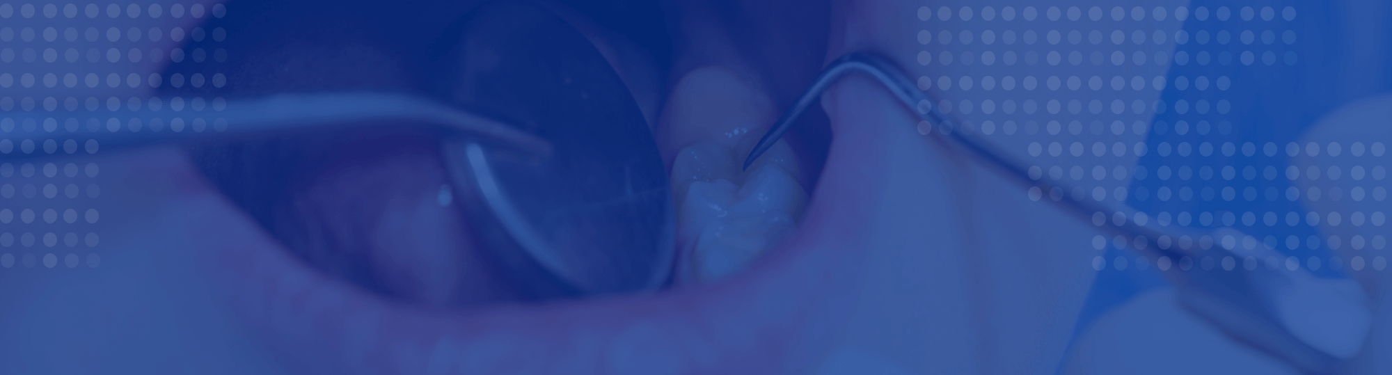 Verstandskiezen trekken | #1 Tandarts | Tandarts van Schiedam